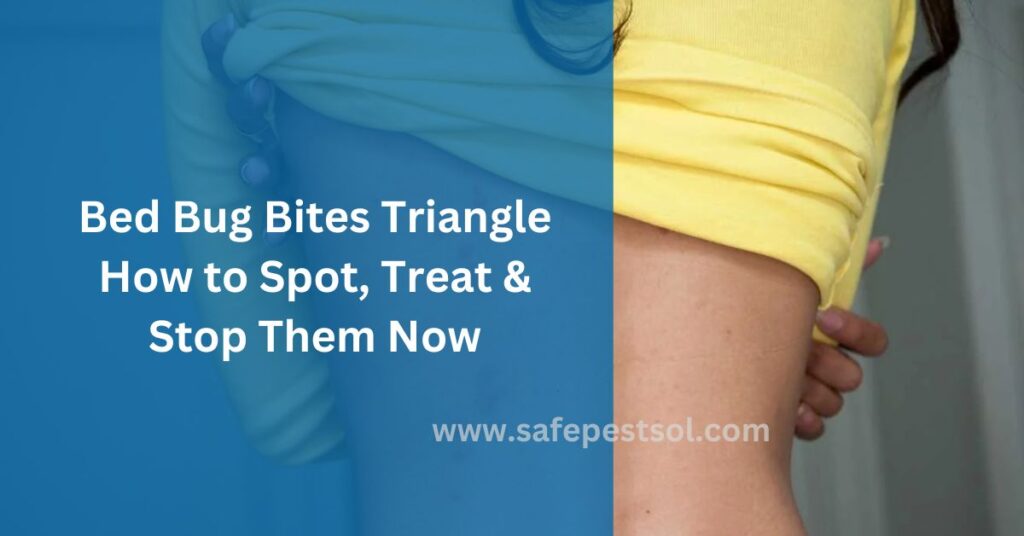 Bed Bug Bites Triangle: How to Spot, Treat & Stop Them Now